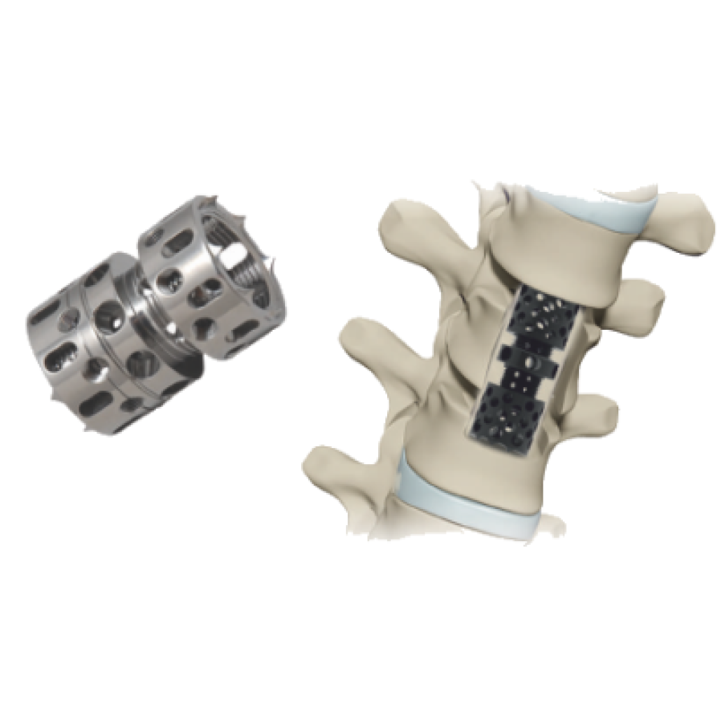 CAGES DE CORPECTOMIE SPINALE CERVICALE - Promedic